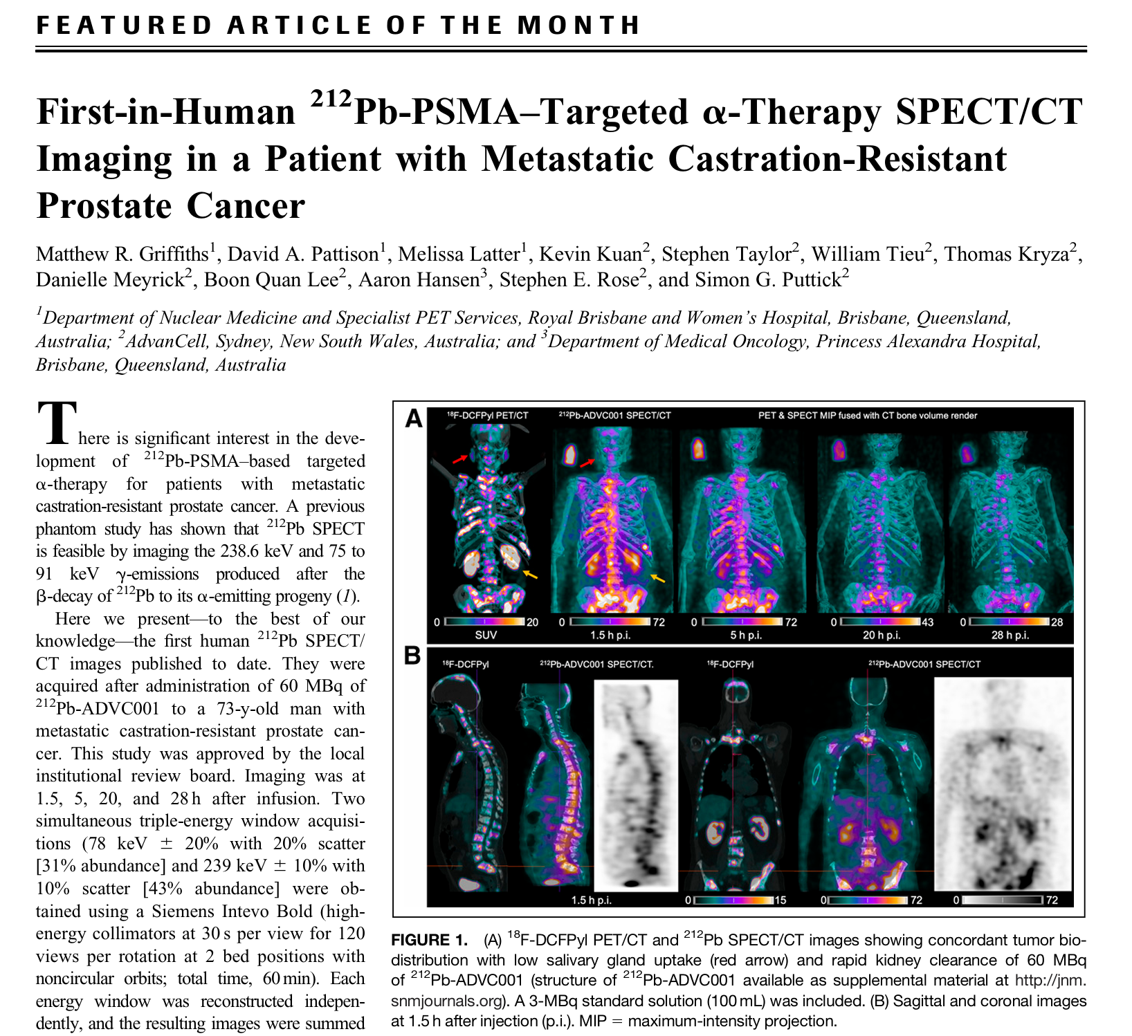 PSMA及其未來展望2025：Pb-212-與Ac-225-PSMA之比較 – 台灣核醫診療標靶治療之友協會